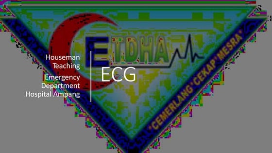 DDELTA WAVE IN ECG AND ITS INTERPRETATION IN ECG | PPTX | Heart and Cardiovascular Diseases ...