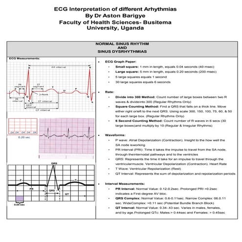 ECG-Interpretation in Critical care medicine | PDF