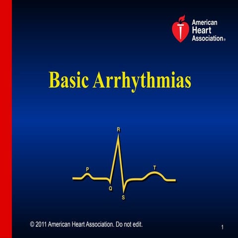 ECG-Slide-Set.pptx the basics of ECG reading | PPT