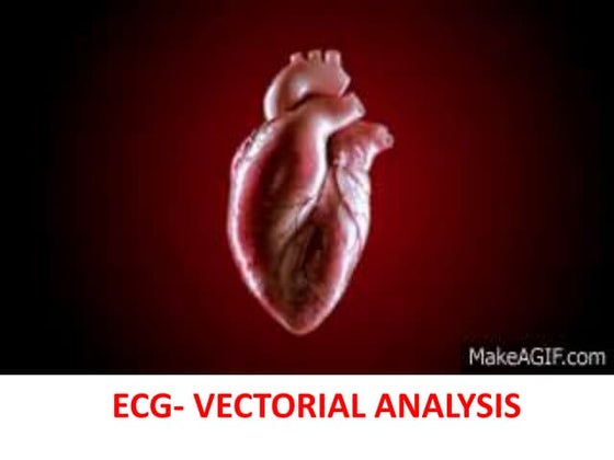 Vectorial analysis of Electrocardiogram | PPT