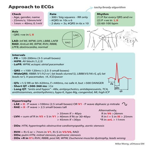 ECG (1).pdf LECTURA RAPIDA DE EKG BASICO. IDIOMA INGLES. CONCISO Y MUY ...