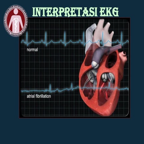 Cara membaca ecg dan interpretasi elektocardiogram | PPT