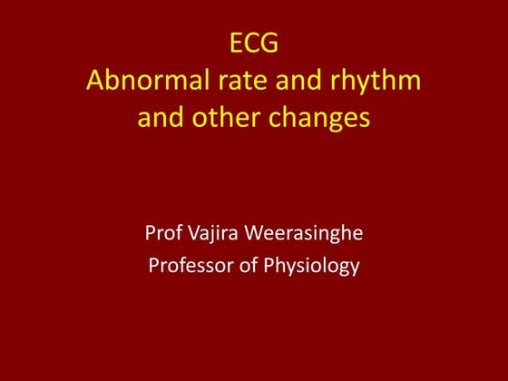 DDELTA WAVE IN ECG AND ITS INTERPRETATION IN ECG | PPTX | Heart and Cardiovascular Diseases ...