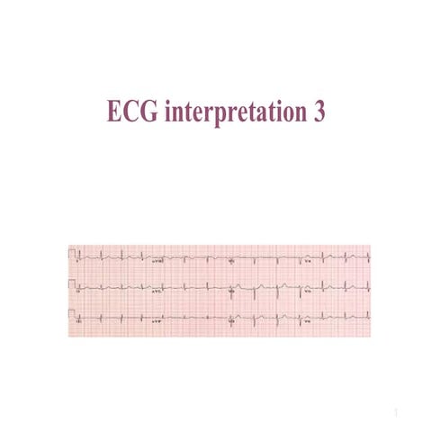 ECG3 (4)_8fdc5e0d009d0dbb3b437c91012fb5ed.pdf