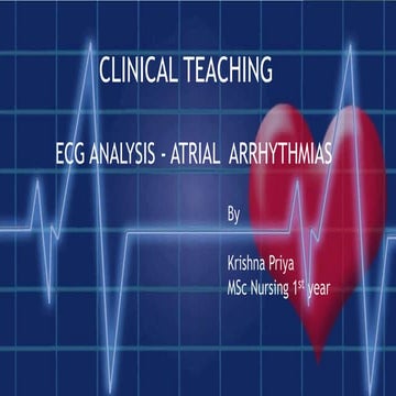 ECG analysis on normal sinus rhythm and atrial arrhythmias.pptx