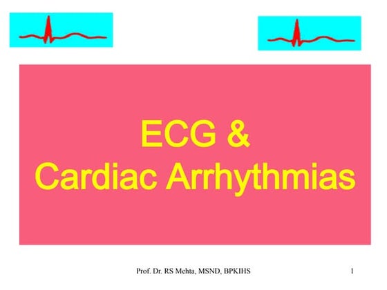 Arrhythmias | PPT