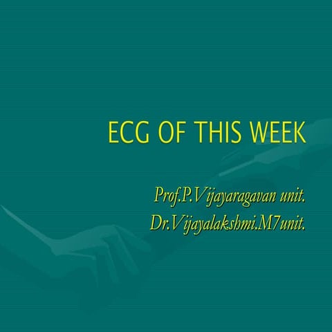 ECG - Narrow complex tachycardia | PPT