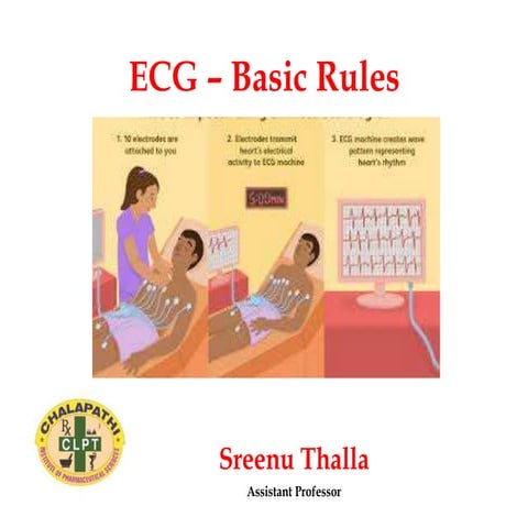 Ecg basic rules | PPT
