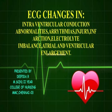 ECG changes, changes in intraventricular conduction | PPTX