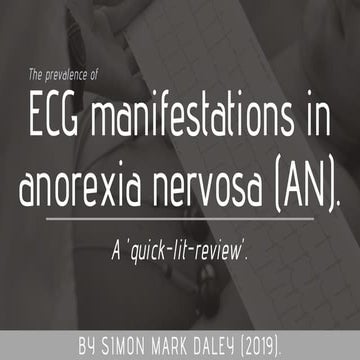 ECG changes in anorexia nervosa | PDF