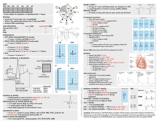 CARDIOLOGY - ECG MADE SIMPLE - HIGH YIELD USMLE | PDF