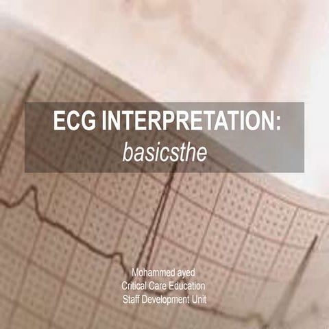 basic ECG SAMPLE WAY | PPTX