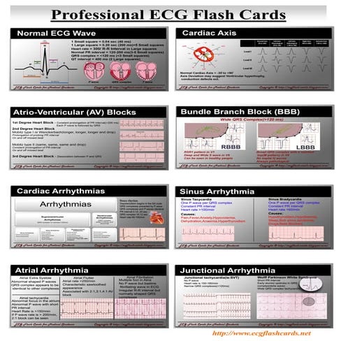 Ecg flash cards_new_complete | PDF | Heart and Cardiovascular Diseases ...