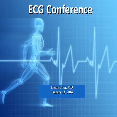 ECG interpretation: the basics | PPT
