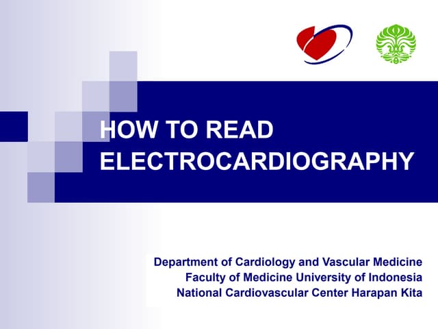 ECG interpretation: the basics | PPT