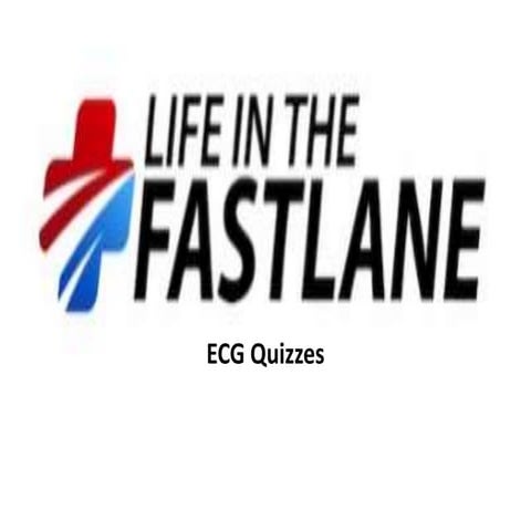 ECG life in the fastlane.pptx