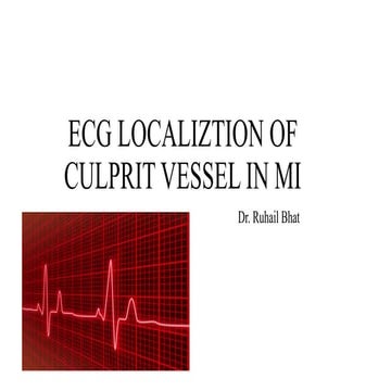 Localization of MI on ECG | PPT