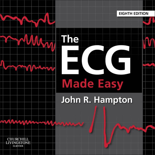 The ECG made easy guide. Guide on how to read ECG's quick and ...