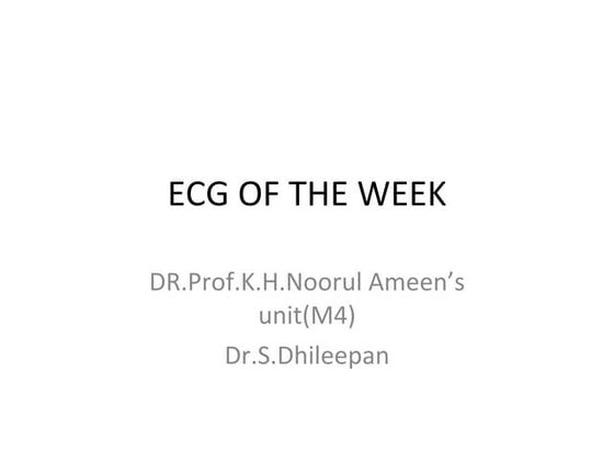 X Ray: Chest-Homogenous opacity | PPT