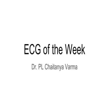 ECG of the weeks | PPTX