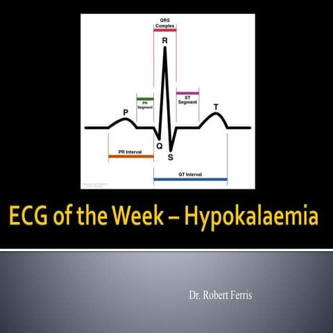 ECG of the Week - Hypokalaemia | PPTX