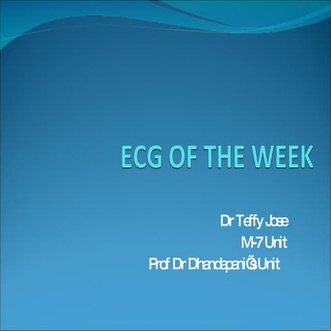 ECG: Crochetage sign | PPT