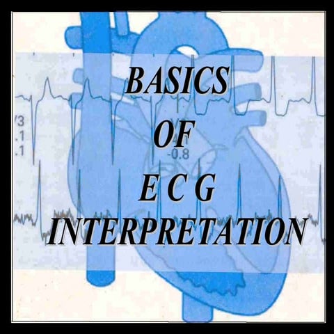 Ecg presentation | PPT