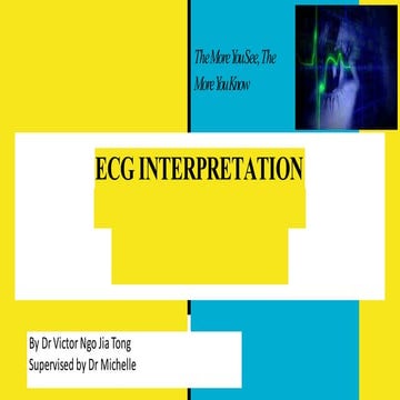 Ecg presentation | PPT