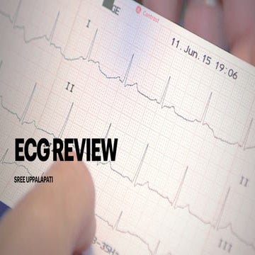ECG REview.pdf