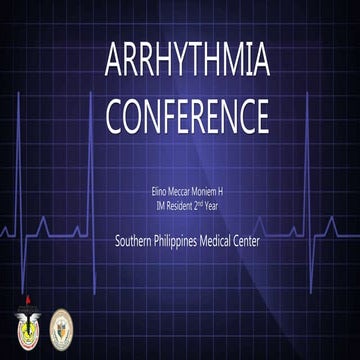 Ecg vtach brugada & vereckei algorithm mec elino | PPTX