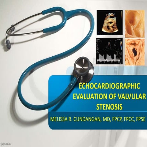 Echo-Evaluation-of-Valvular-Stenosis-Cundangan.pdf