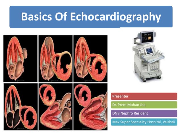ECHO WINDOWS AND VIEWS.pptx