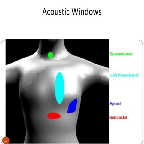 Echocardiogram acoustic windows | PPTX