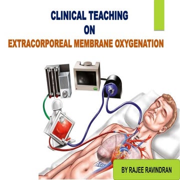 Extracorporeal Membrane Oxygenation