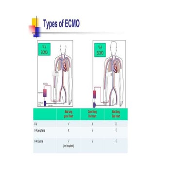 ECMO.pptx