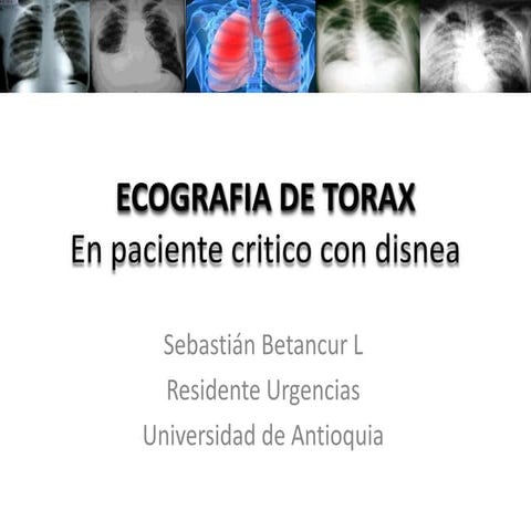 Ecografia de torax y Protocolo BLUE | PPT