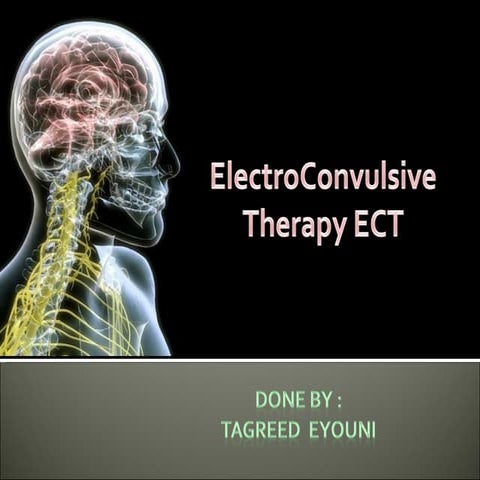 ECT | PPT