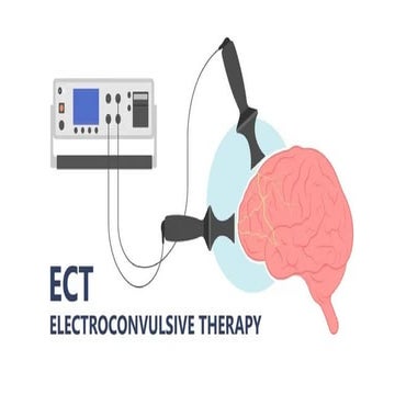 Electro Convulsive Therapy for Nursing students | PPT