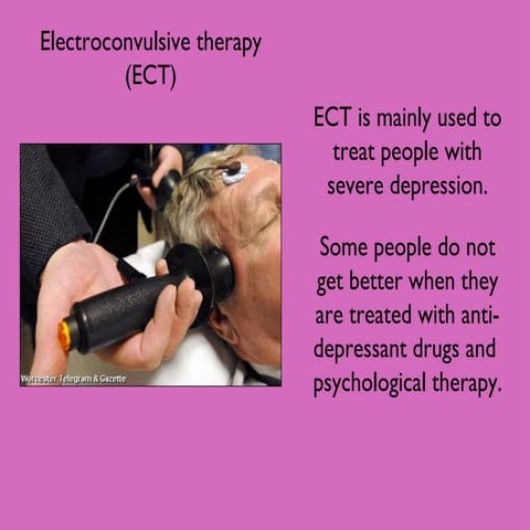Ect2 | PPT | Brain and Nervous System Disorders | Diseases and Conditions