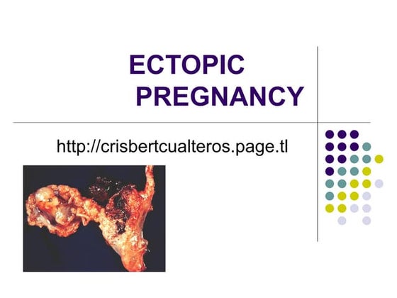 Ectopic Pregnancy | PPTX | Infertility | Reproductive Health