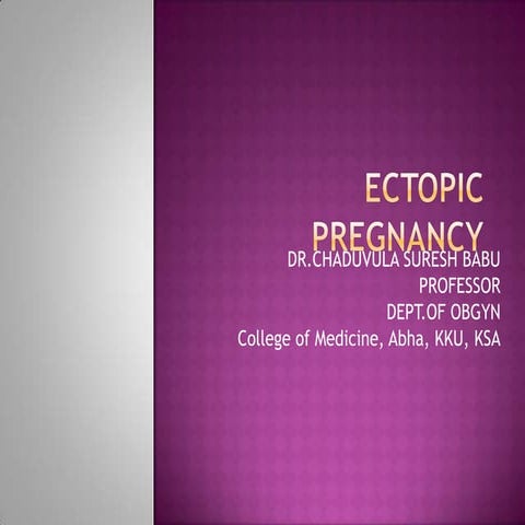 Ectopic pregnancy | PPT
