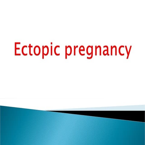 Ectopic Pregnancy.ppt ppt on ectopic pregnancy | PPT