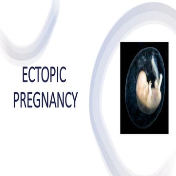ECTOPIC PREGNANCY lecture.pptx