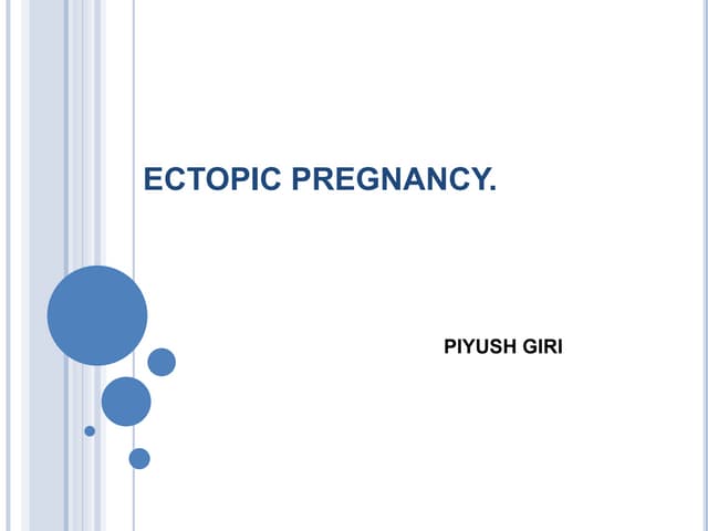 Ectopic pregnancy piyush giri | PPT Ectopic pregnancy piyush giri | PPT