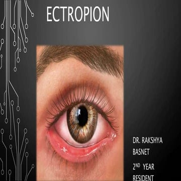 Ectropion and Entropion (Ophthalmology) - Etiology, Management
