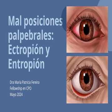 entropion y ectropion en oftalmologia y cpo | PPTX