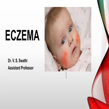 eczema complete information including treatment | PPTX