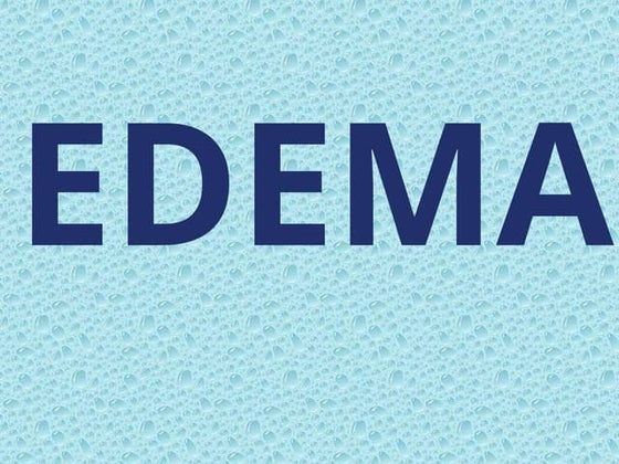 Pathophysiology of edema | PPT