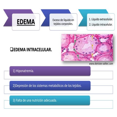Edema - Fisiología | PPTX
