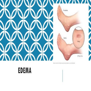 Edema tema general para exposición grupal | PDF